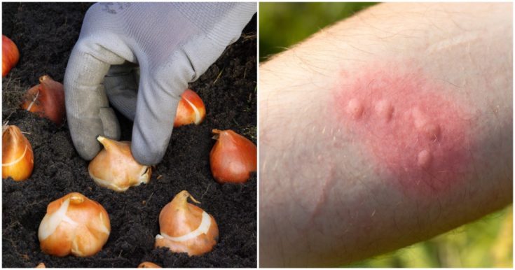 8 Surprising Plants That Can Seriously Irritate Your Skin